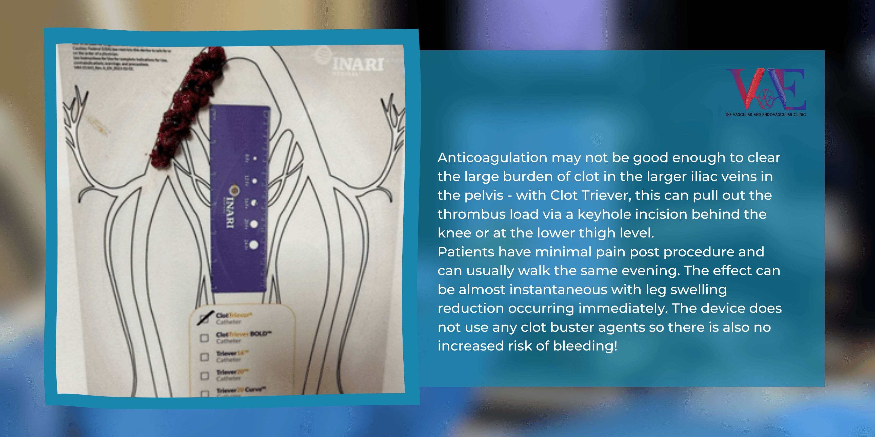 The Vascular Clinic: Recent Interviews and Featured Articles