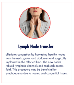 A Guide to Lymphoedema: Causes, Symptoms, Treatments