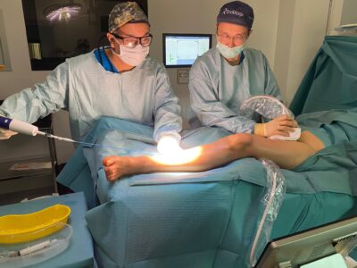 What is Venaseal, How Does it Work and Treatment Options